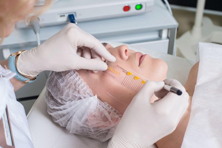 Ultherapy Treatment - Benefits, Costs, Results & Procedure Steps