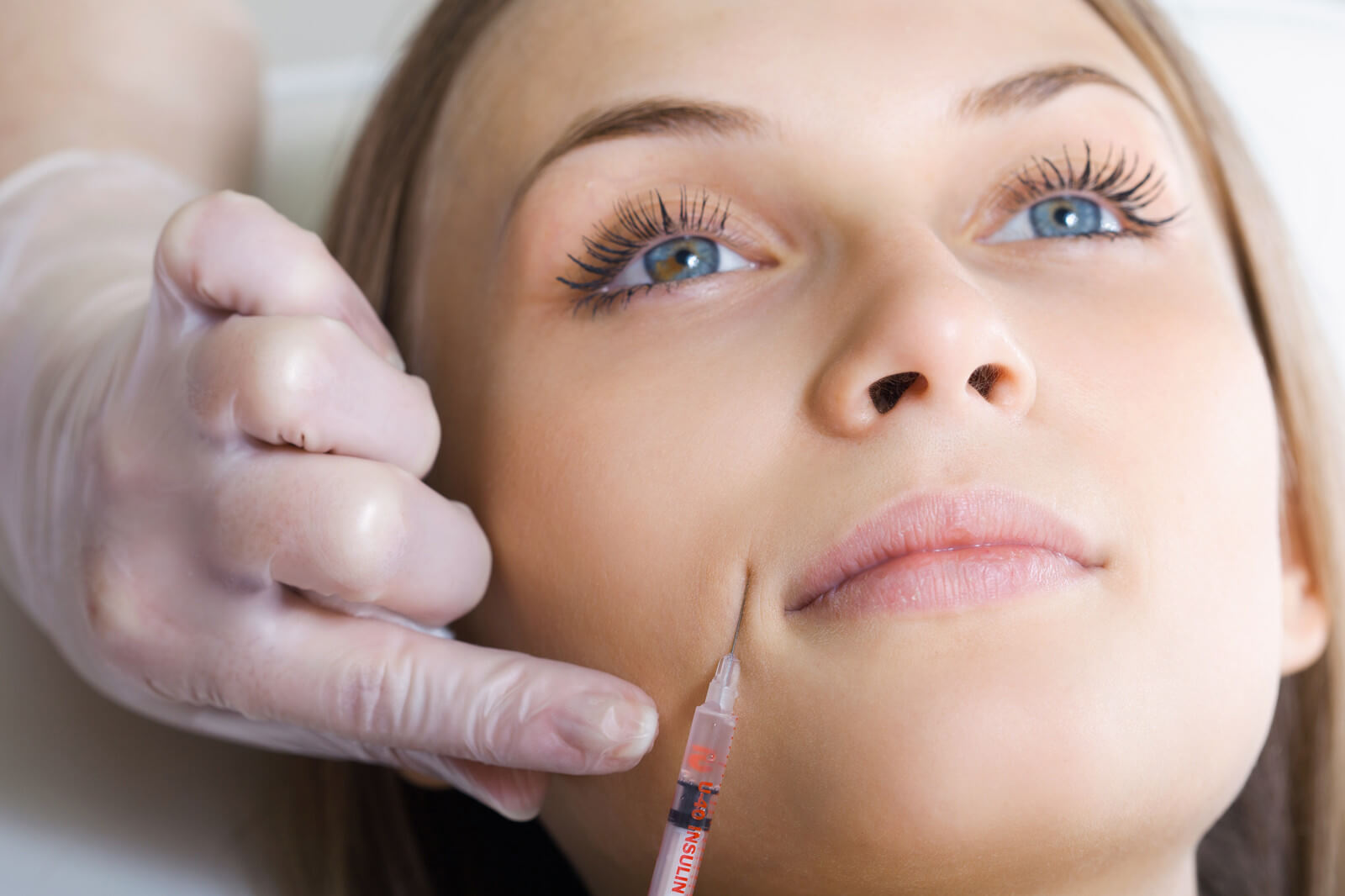 Smile Line Treatment NYC - 25% Off – Skinly Aesthetics